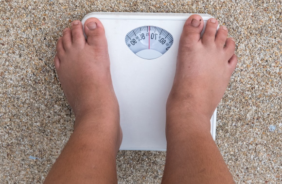 Professor works to advance ‘fat justice’ | The College Fix