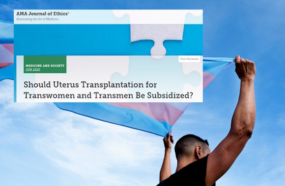 Scholars argue for uterus transplant coverage for biological males ...